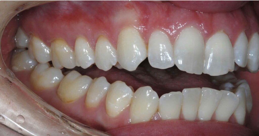 John R. Droter, DDS | Facial Pain Diagnosis and Treatment