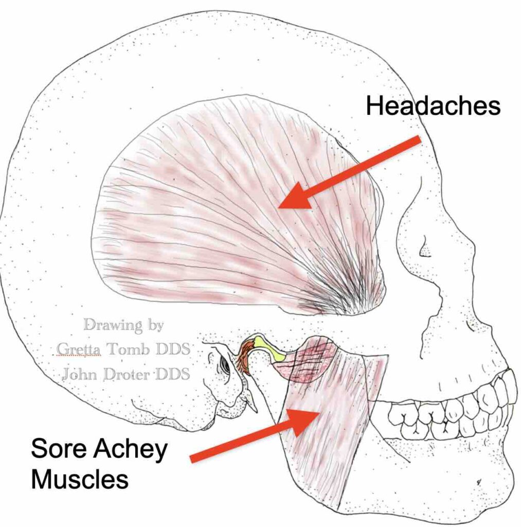 John R. Droter, DDS | Facial Pain Diagnosis and Treatment