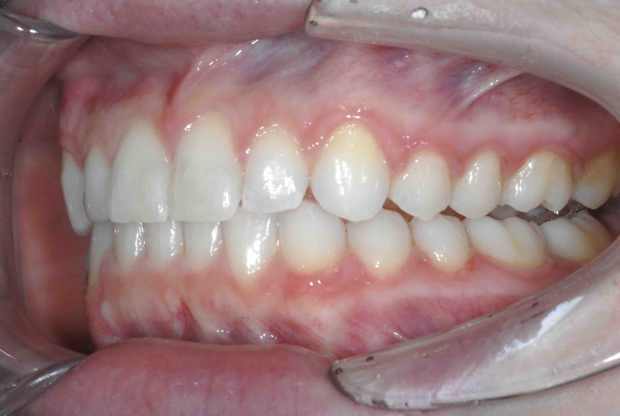 John R. Droter, DDS | Facial Pain Diagnosis and Treatment